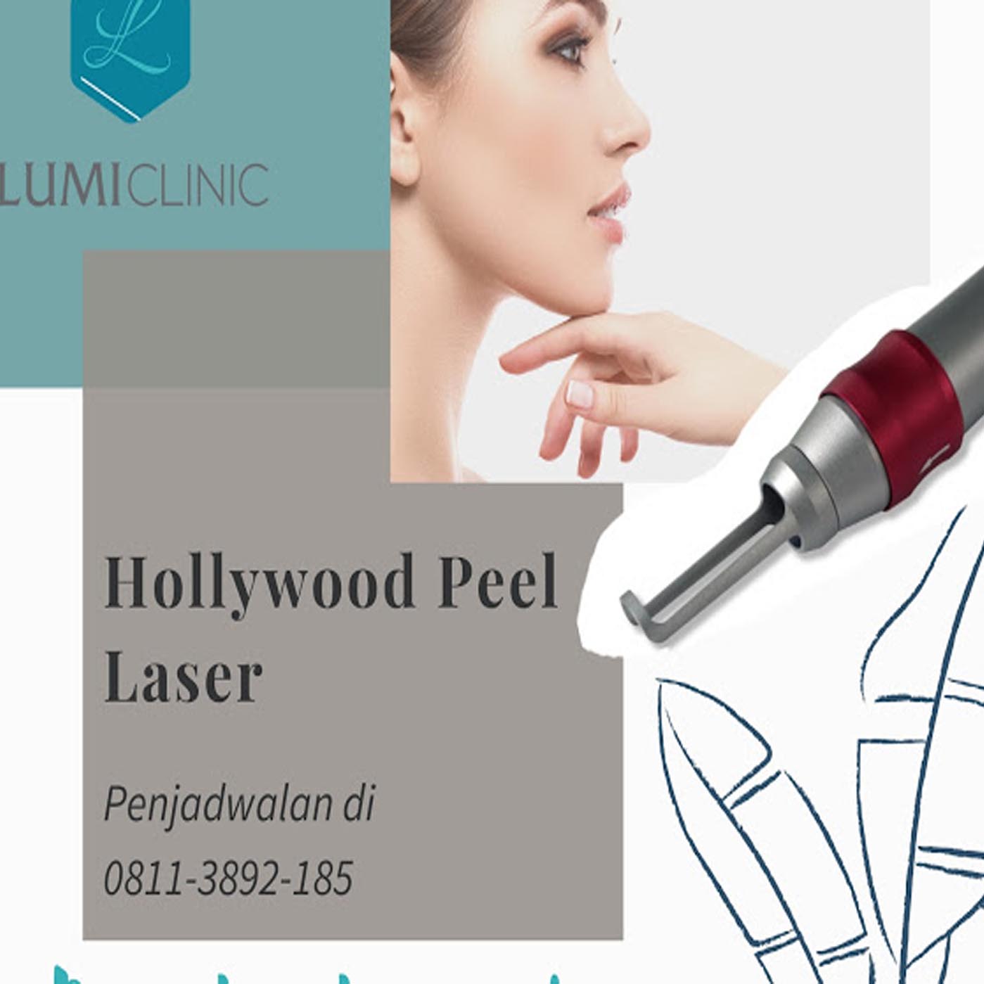 Laser hollywood peel, – Lumi Clinic