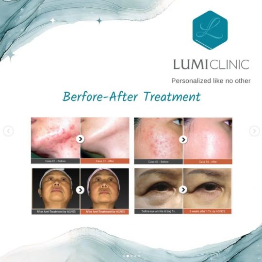 Lumi Clinic – Personalized like no other