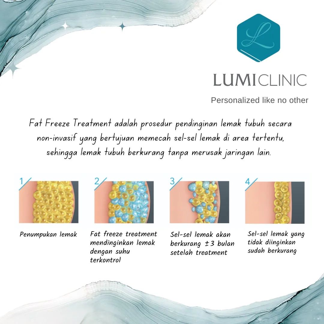 Fat Freeze Treatment – Lumi Clinic
