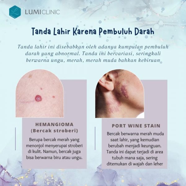 Bubble Study Echocardiogram – Lumi Clinic